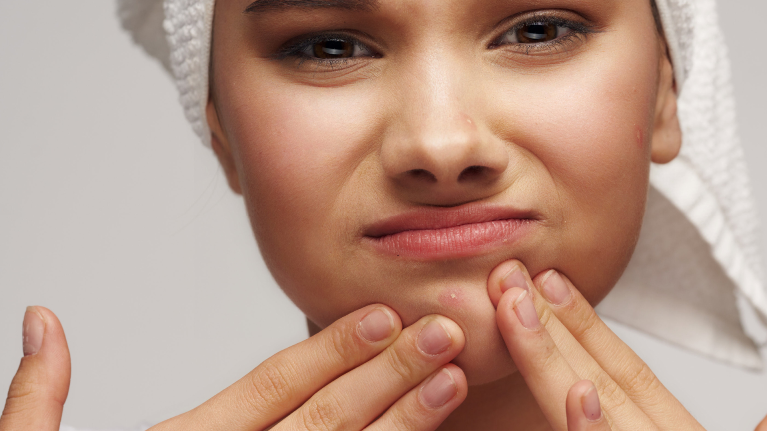 Giluminiai spuogai. Dėl ko jie atsiranda ir kaip gydyti? - B